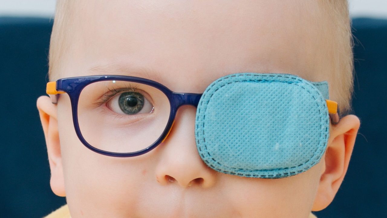 Lazy Eye: What Are the Causes and Treatments? - iCare Top Affordable ...
